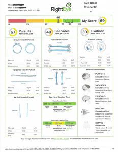 Neuro-opt Eye Exam - Eye Brain Connection